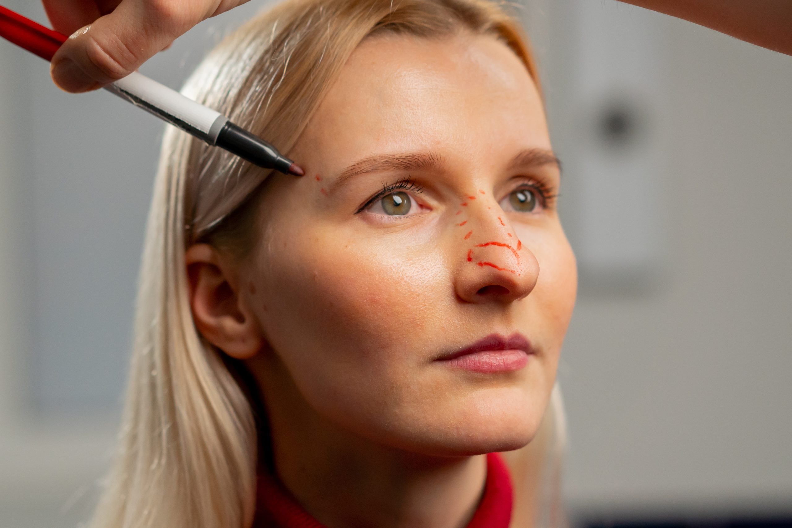 Will There Be Visible Scars After Rhinoplasty Surgery? - Dr. Richard Ha